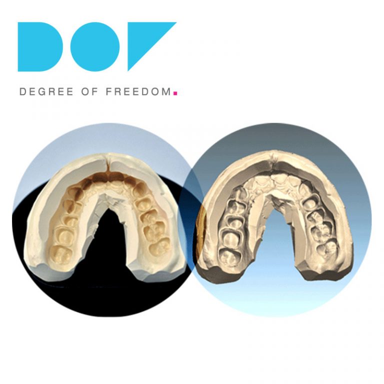 DOF – Freedom HD Dental Scanner | Metrodent