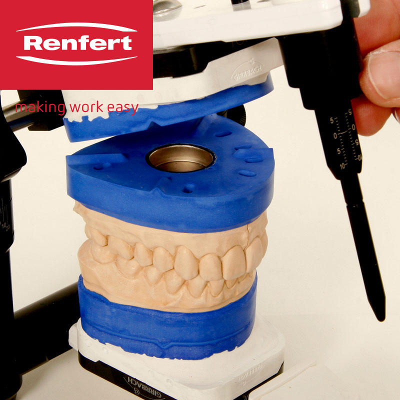 Renfert – Pin-Cast | Metrodent